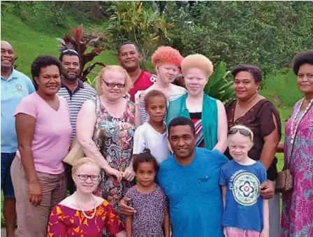 Dr Swamy shines light on Albinism: Embracing diversity and challengin­g ...