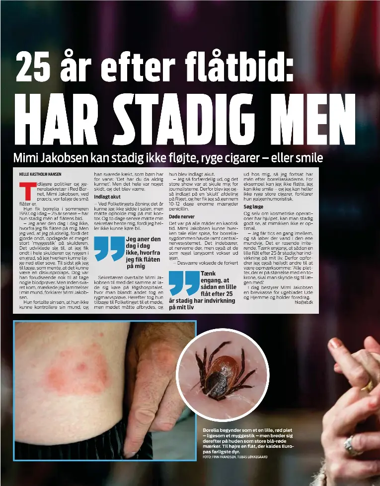 25 år efter flåtbid: HAR STADIG MEN - PressReader