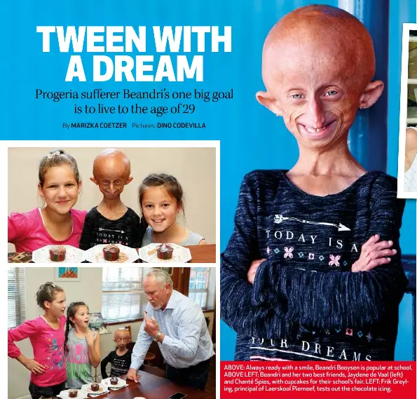 Progeria girl’s big dream - PressReader