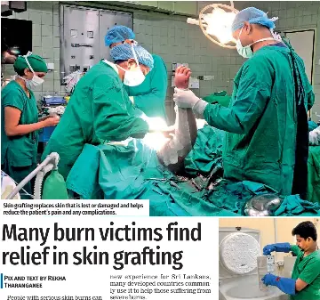 Many burn victims find relief in skin grafting - PressReader