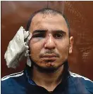 Moscow terror attack suspect ‘had ear cut off during interrogat­ion ...