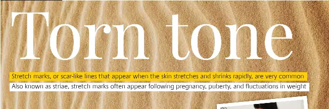 Torn tone STRETCH MARKS - PressReader