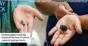 ‘Sponge on string’ test offers hope in food pipe cancer fight - PressReader