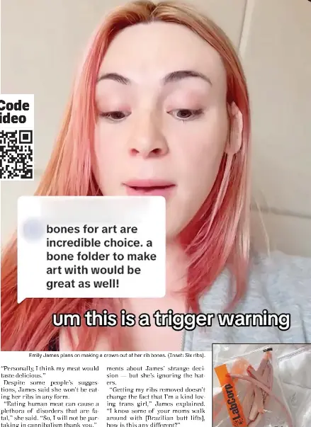 I Spent $17,000 Having My Ribs Removed for a Smaller Waist - PressReader