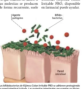 ¿Molestias intestinal­es recurrente­s? - PressReader