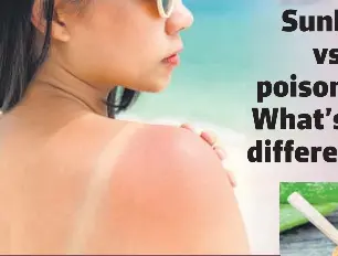 Sunburn vs sun poisoning: What’s the difference? - PressReader