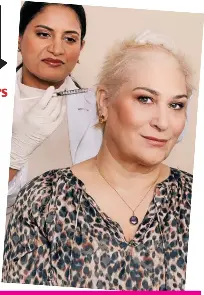 Can stinging injections into my scalp REALLY bring my hair back ...