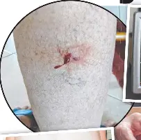 Wallaby attacks terrifying retirees - PressReader
