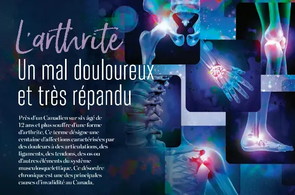 L'arthrite Un mal douloureux et très répandu - PressReader