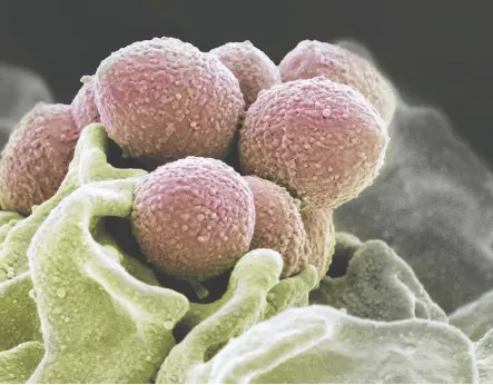 Flesh-eating bacteria on the rise - PressReader