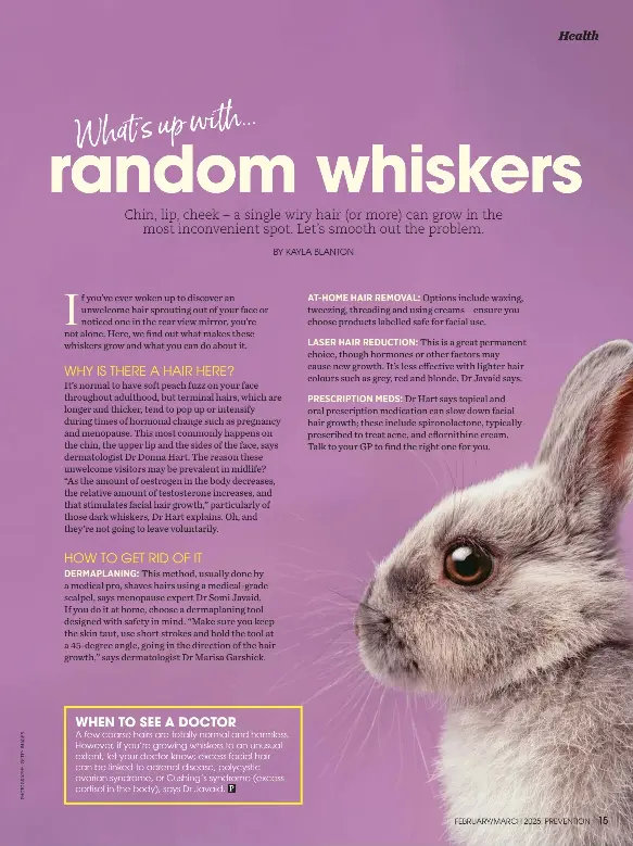 What'supwith... random whiskers - PressReader
