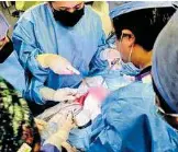 Realizan con éxito cirugía fetal en el CAE - PressReader