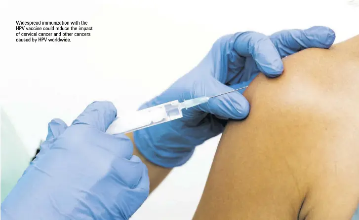 HPV vaccine: Who needs it, how it works - PressReader