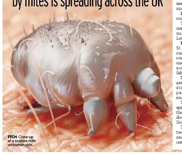 SCABIES ALERT - PressReader