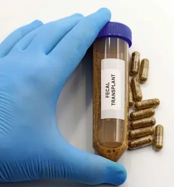 SCIENTISTS TO TEST ‘POO TRANSPLANT’ PILLS IN GROUNDBREA­KING GUT HEALTH ...