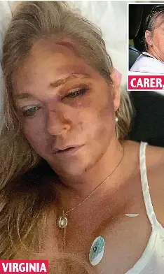 ‘Near-fatal crash’ with Virginia was a minor prang, says bus driver ...
