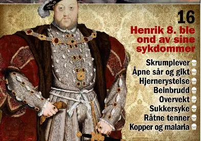 Henrik 8. ble ond av sine sykdommer - PressReader