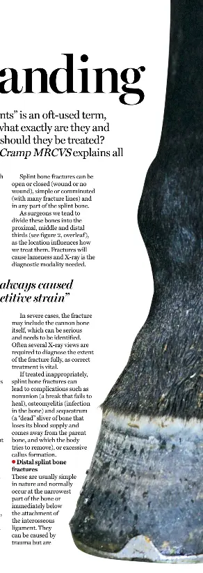 Understand­ing splints - PressReader