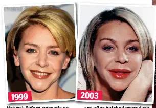 Leslie Lips Gone Wrong | Lipstutorial.org