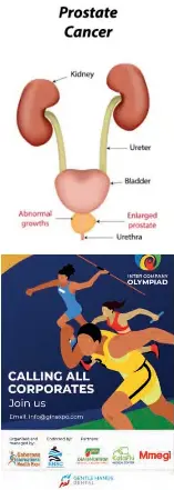 Prostate Cancer: Causes, Symptoms, and Treatment - PressReader