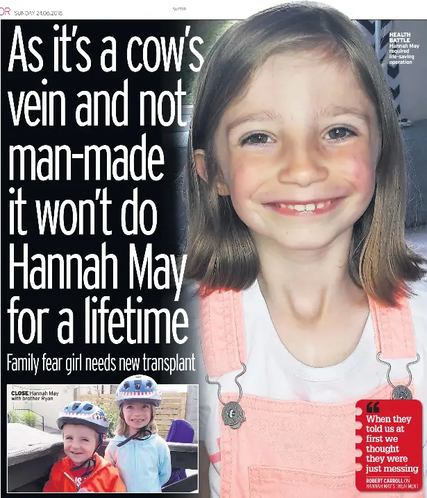 As it’s a cow’s vein and not man-made it won’t do Hannah May for a ...