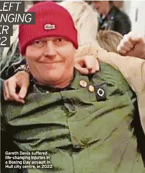 Death of assault victim - PressReader
