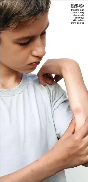 Why did son’s insect bites flare up weeks after family holiday ...