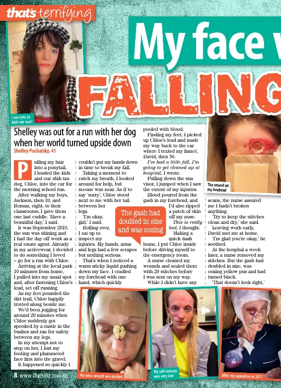 My face was FALLING OFF - PressReader
