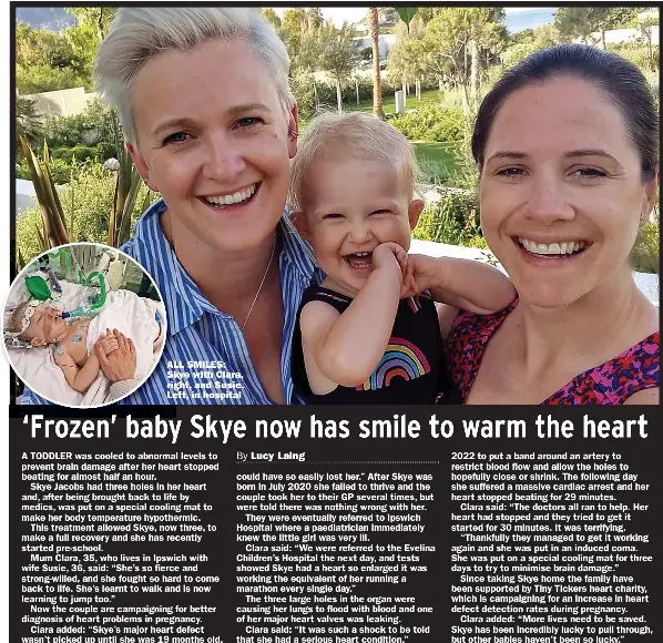 ‘Frozen’ baby Skye now has smile to warm the heart - PressReader