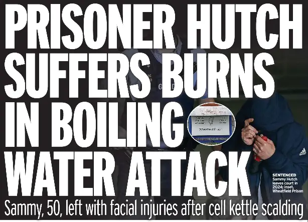 PRISONER HUTCH SUFFERS BURNS IN BOILING WATER ATTACK - PressReader
