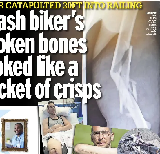 Crash biker’s broken bones looked like a packet of crisps - PressReader