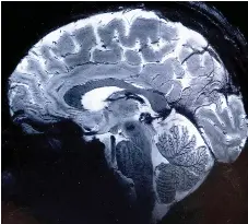 World's most powerful MRI scans first images of human brain - PressReader