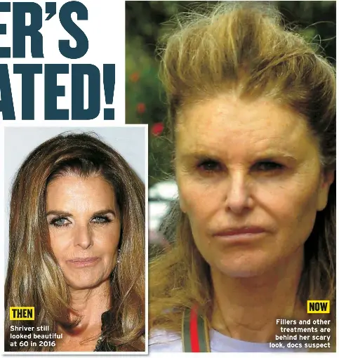 MARIA SHRIVER’S FACE TERMINATED! - PressReader