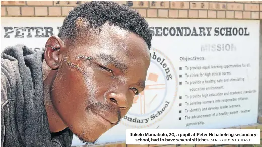 Pupil needs stitches after teacher attack - PressReader