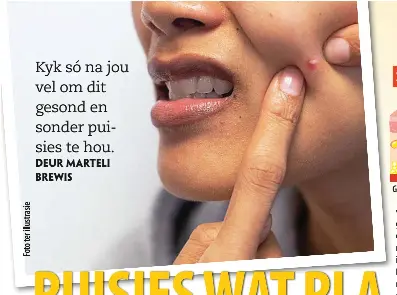 Puisies: Versorg en voorkom velproblem­e - PressReader