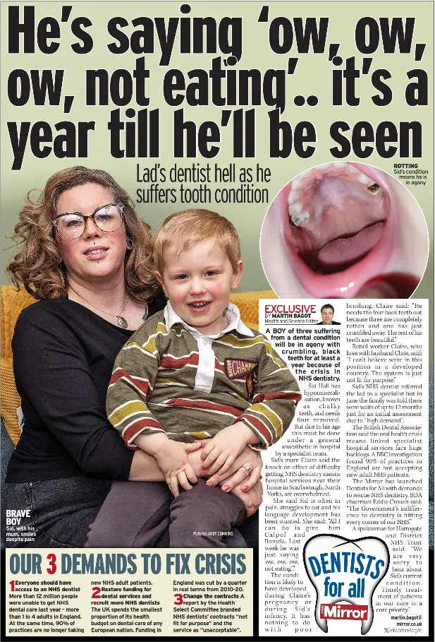 He’s saying ‘ow, ow, ow, not eating’.. it’s a year till he’ll be seen ...