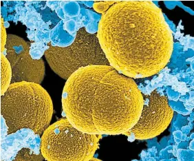 How we study microbes keeps us from realizing their potential benefits ...