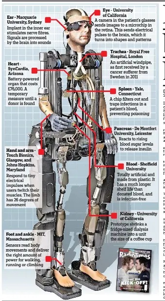 Meet Rex, the real bionic man (and he didn’t cost $6m!) - PressReader
