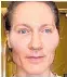 Millionair­e’s face ‘blows up’ under anti-ageing plan - PressReader
