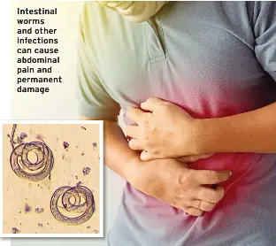 SIGNS YOU HAVE BELLY PARASITES - PressReader