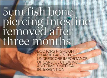 5cm fish bone piercing intestine removed after three months - PressReader