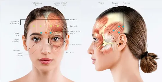 Treating Migraines with Botulinum Toxin - PressReader