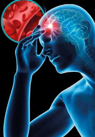 How to survive a stroke - PressReader