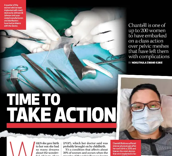 SA’s pelvic mesh class action - PressReader