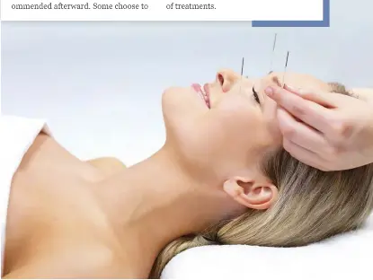 Facial acupunctur­e - PressReader