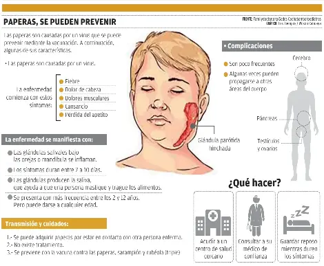 Seis contagios de paperas obligan a unidad educativa a suspender clases ...