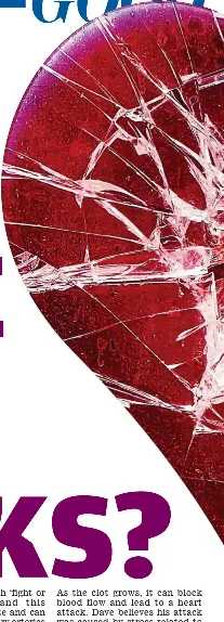 Why ARE so many YOUNG PEOPLE having HEART ATTACKS? - PressReader