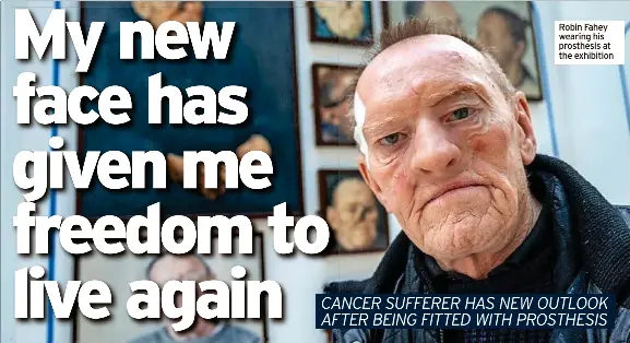 My new face has given me freedom to live again - PressReader