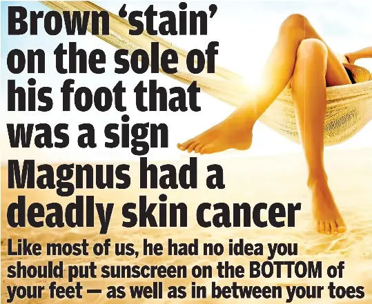 Brown ‘stain’ on the sole of his foot that was a sign Magnus had a ...