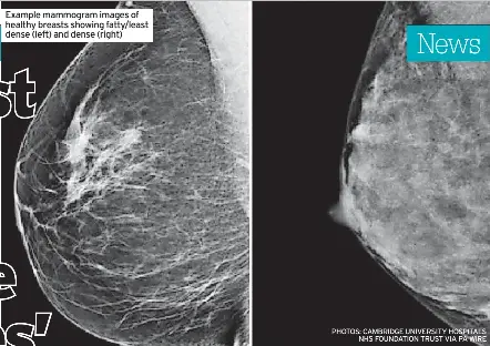 Extra breast screening scans ‘can help to save 100s of lives’ - PressReader